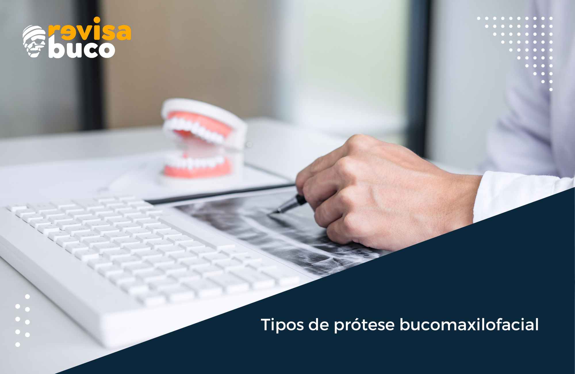 Prótese bucomaxilofacial: o que é e para que serve? - Revisa